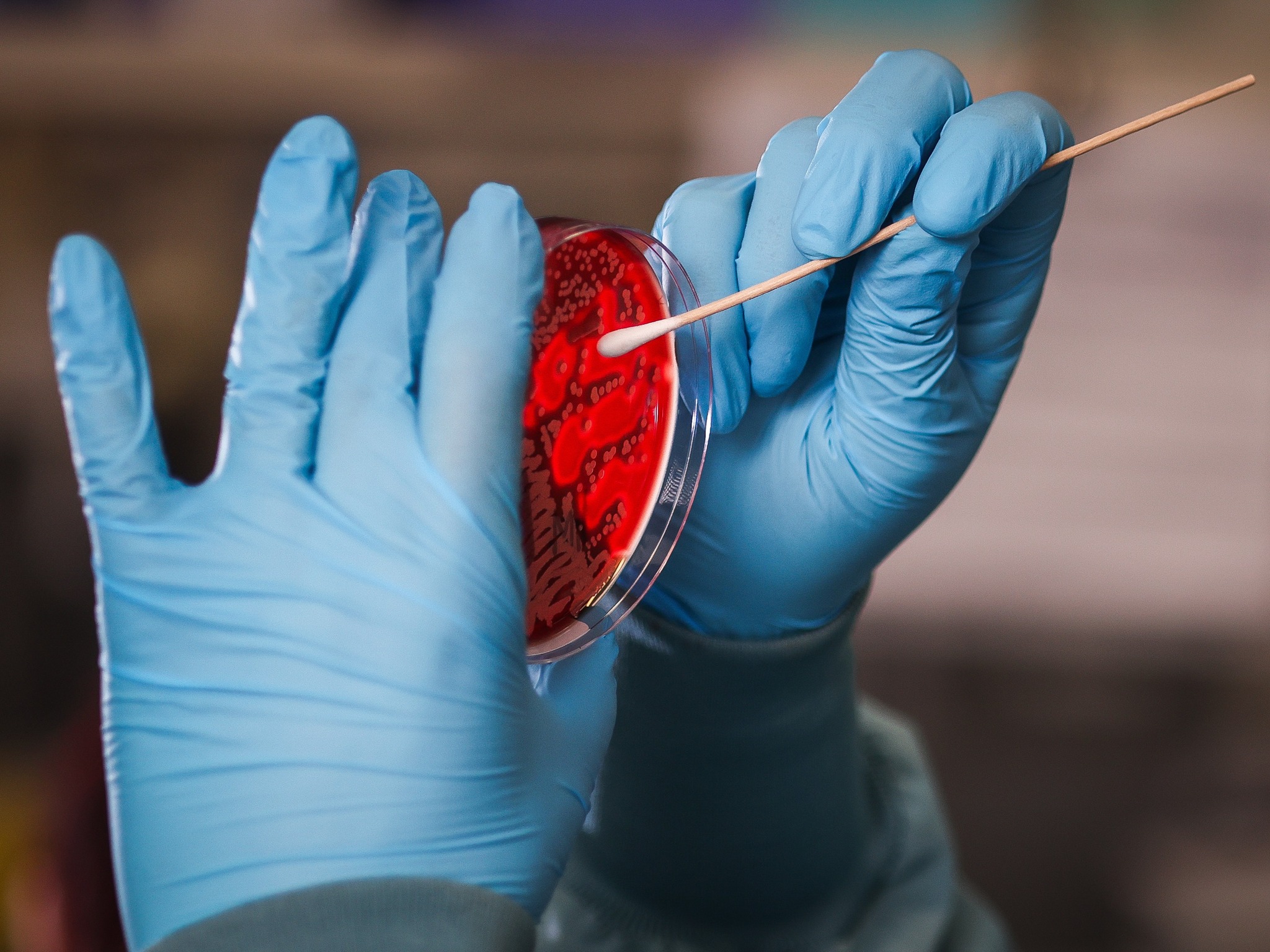 Whooping cough scare in Airdrie school – What parents need to know ...