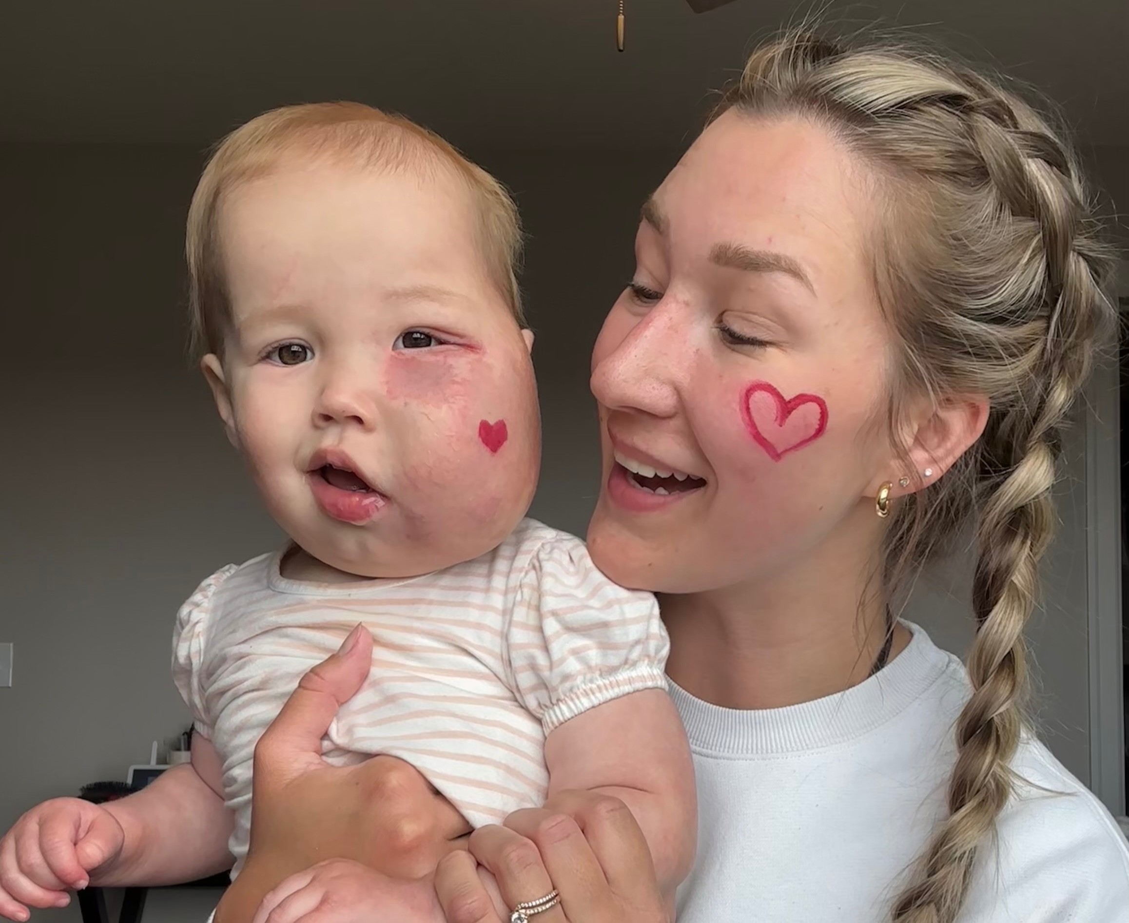 ‘The happiest little girl’: Airdrie toddler with rare disorder must go ...