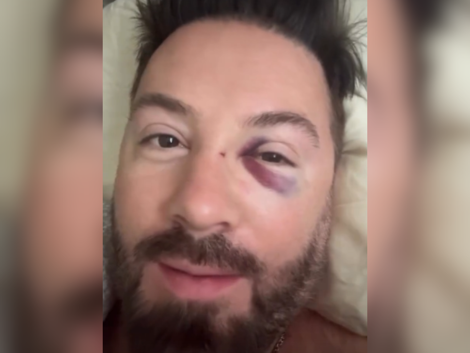 Danny Gokey asks for prayers after suffering painful injury - ReachFM ...